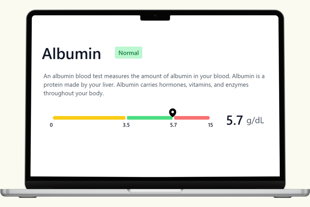 Albumin Blood Test - Nutrition Deficiency Biomarkers – PlexusDx