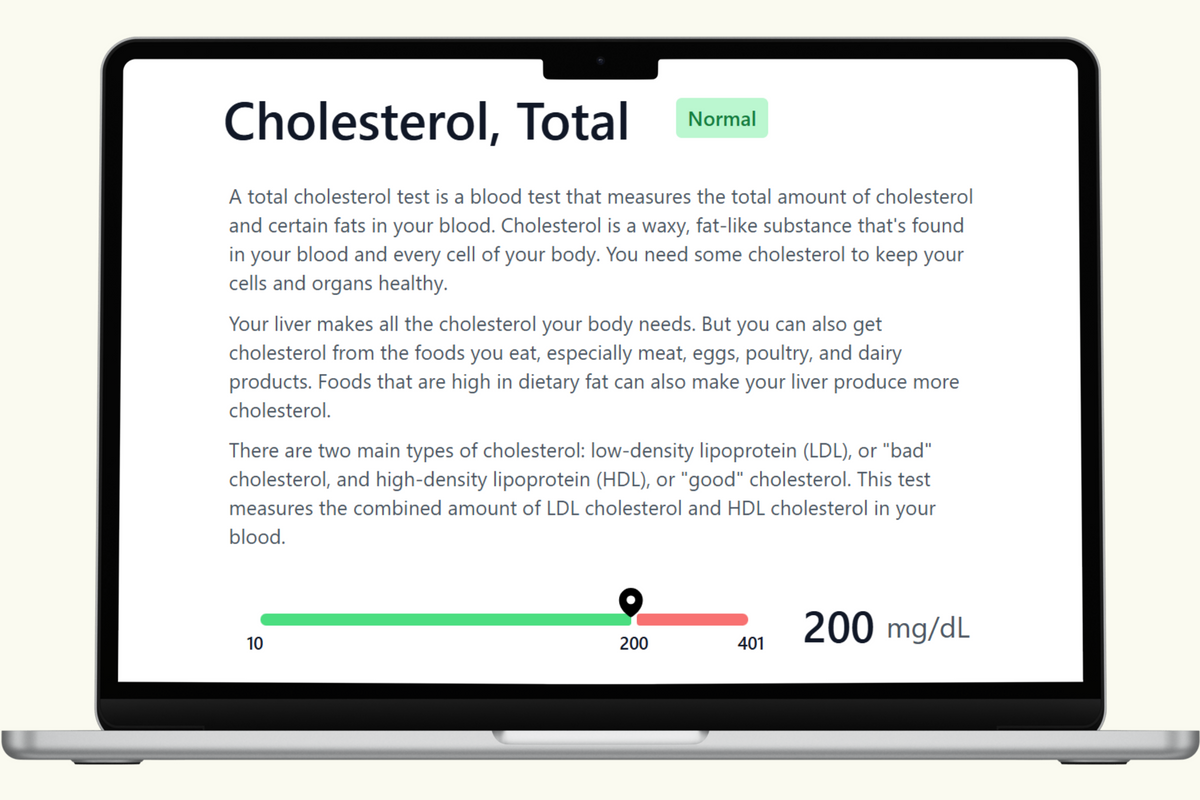 Cholesterol Blood Test – PlexusDx