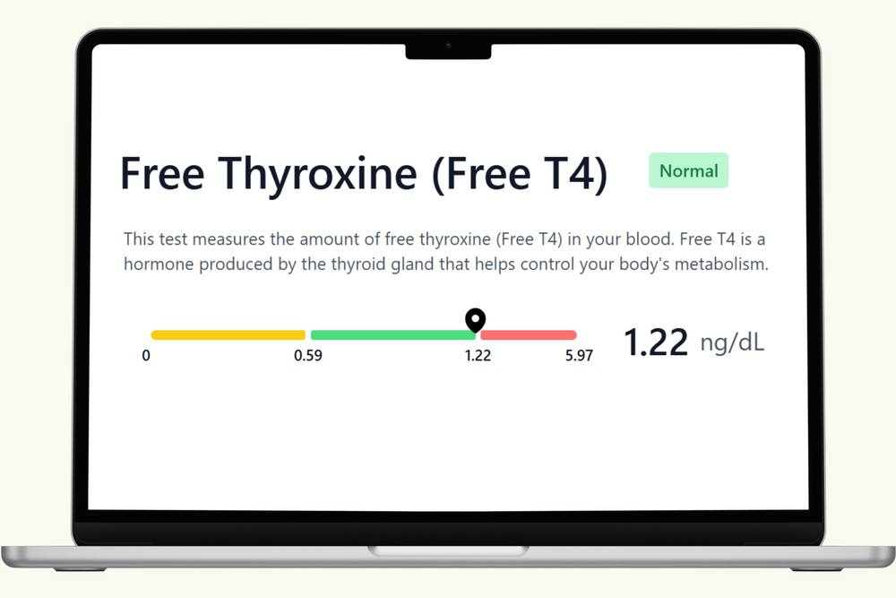 Free T4 Blood Test - Men's Health & Wellness Panel – PlexusDx