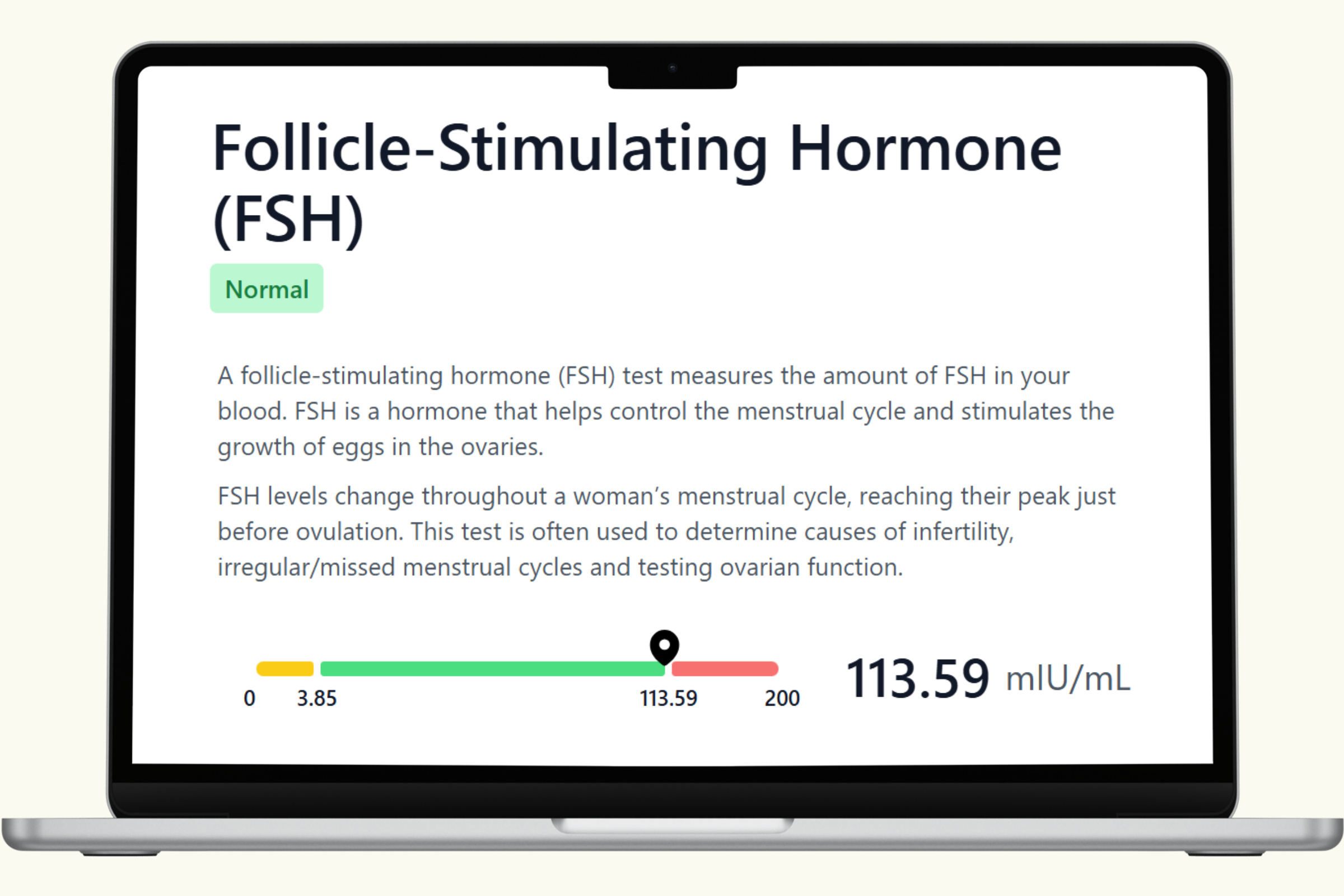 Follicle-Stimulating Hormone (FSH) Blood Test - Women's Health ...