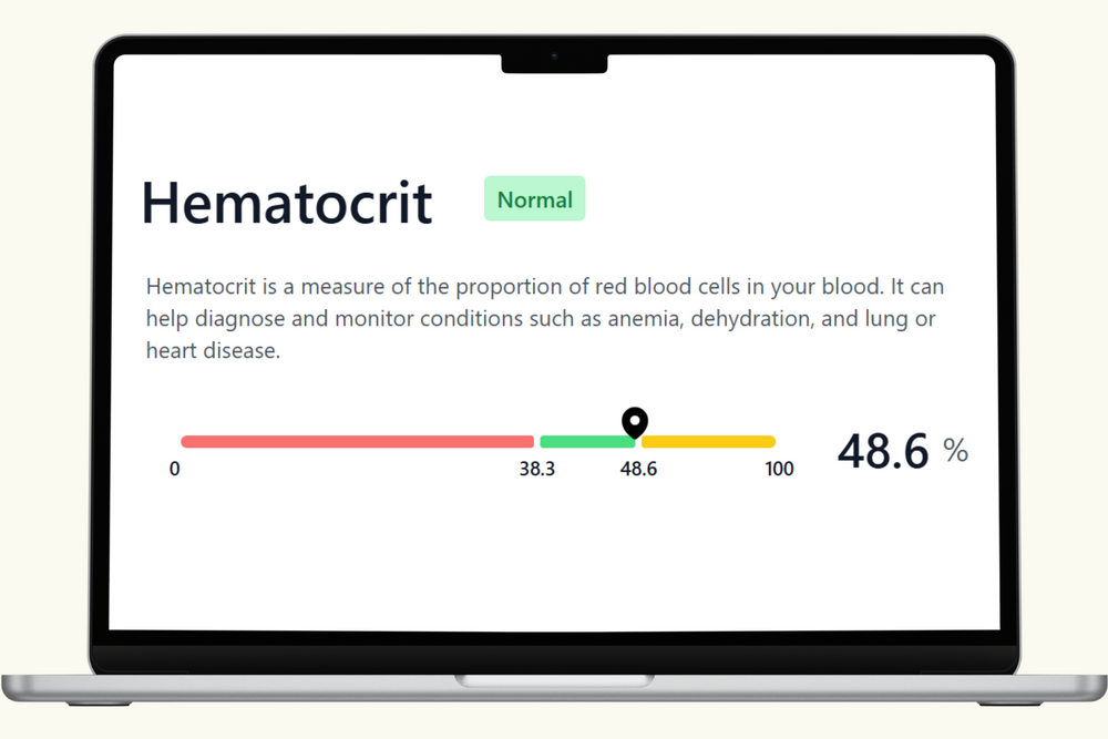 Hematocrit Blood Test - Nutrition Deficiency Biomarkers – PlexusDx