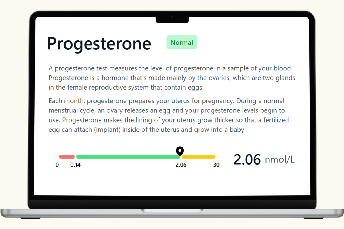 Progesterone Blood Test - Women's Health & Wellness – PlexusDx